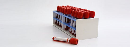 Most Common Diagnostic Tests Corona Pathology most-common-diagnostic-tests-corona-pathology